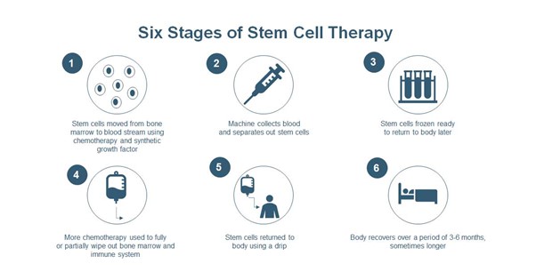 Can Stem Cell Therapy Defy Aging?